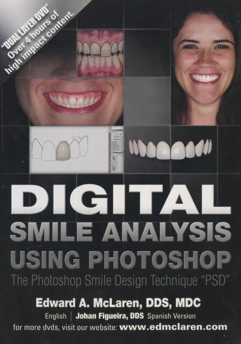 Digital Smile Analysis Using Photoshop – NeverDieMedia